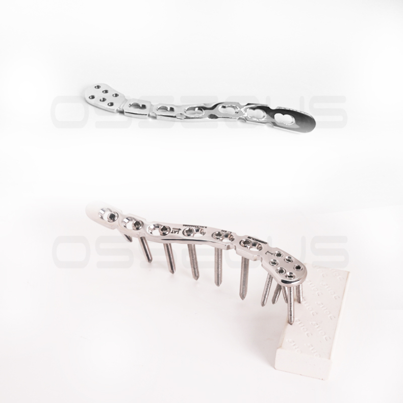 Osseous Surgical – We build Orthopaedic implants & instruments